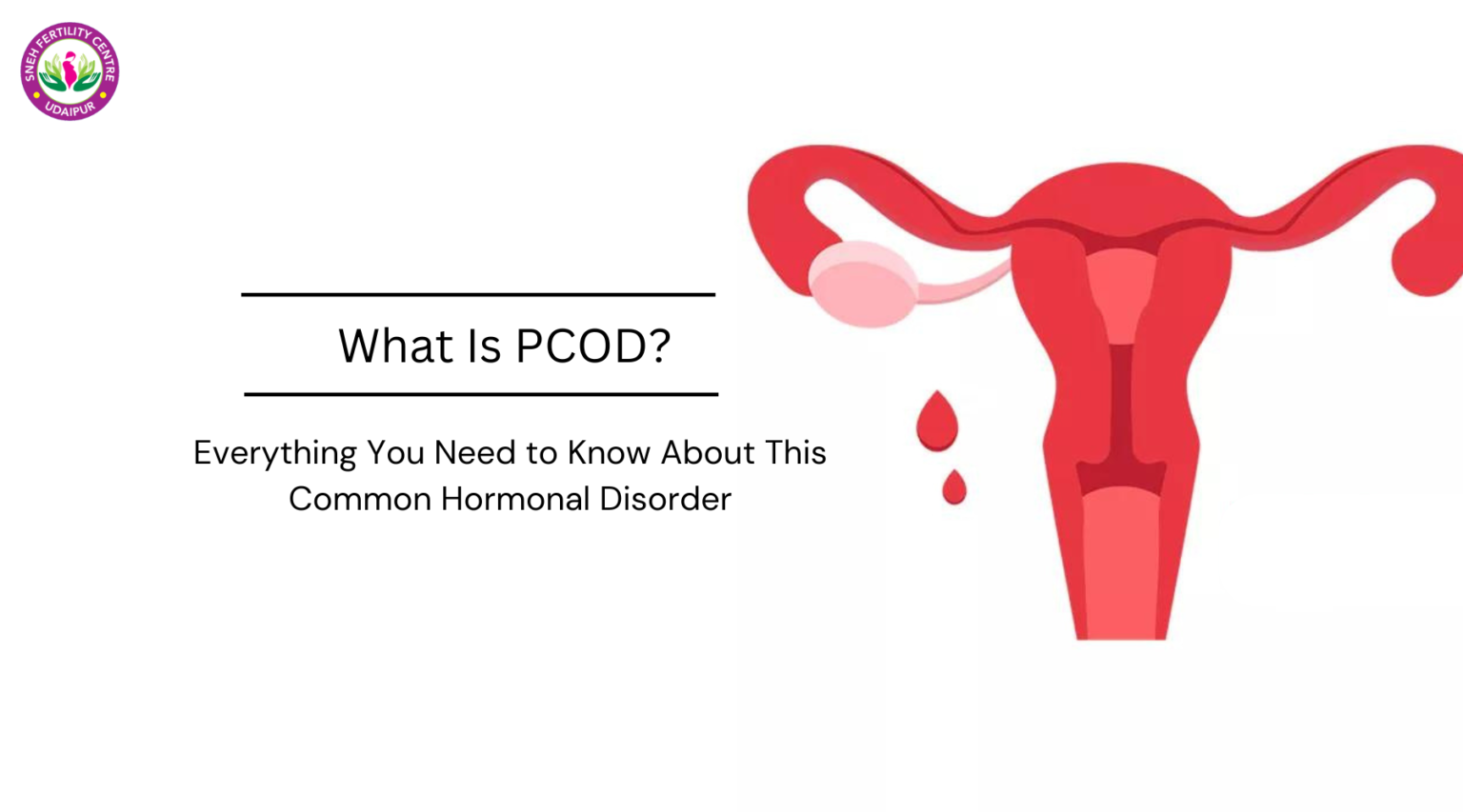 What Is PCOD? Everything You Need to Know About This Common Hormonal ...