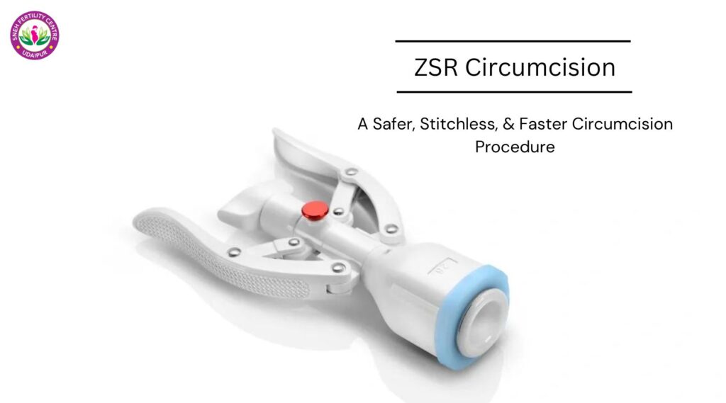 ZSR Circumcision: A Safer, Stitchless, & Faster Circumcision Procedure